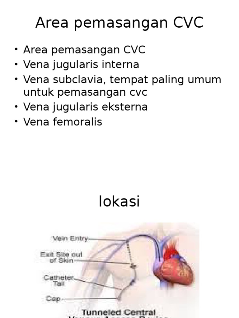 Area Pemasangan CVC | PDF