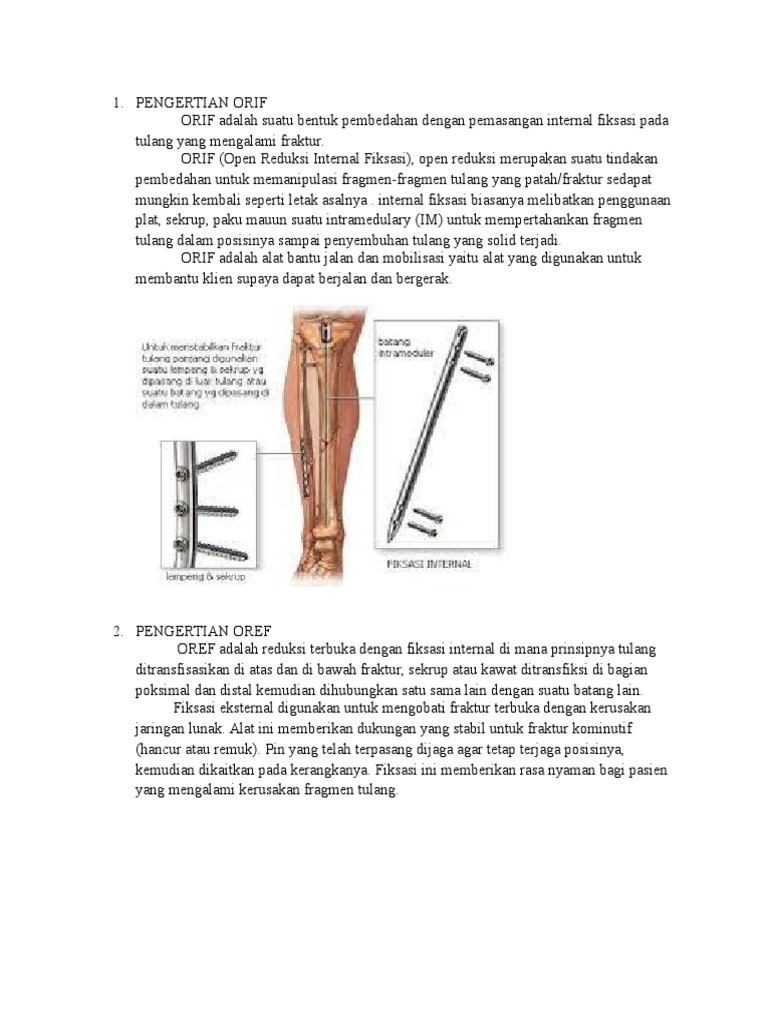Pengertian Orif | PDF
