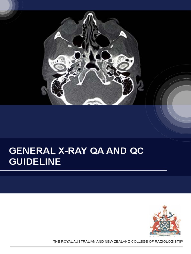General X-ray QA and QC Guideline | Quality Assurance | Radiology
