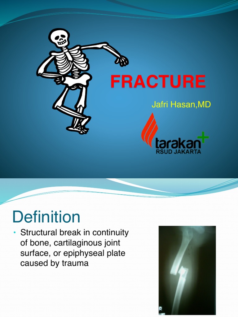 Fracture | PDF | Bone | Clinical Medicine