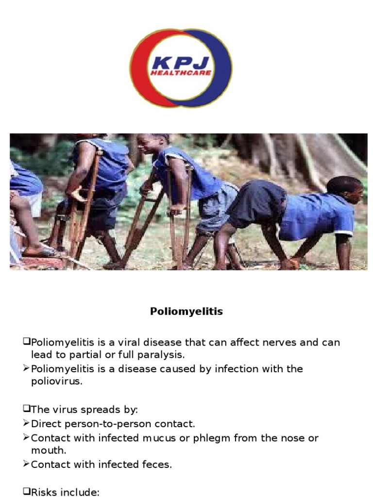 Post Polio Syndrome (PPS) | PDF | Poliomyelitis | Human Anatomy