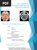 Escala ASPECTS | PDF