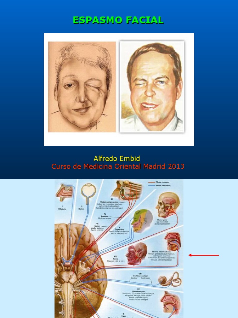 Espasmo Facial 2013 | PDF | Medicina CLINICA | Medicina