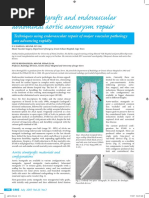 GORE® EXCLUDER® Endoprosthesis IFU | PDF | Aorta | Ischemia