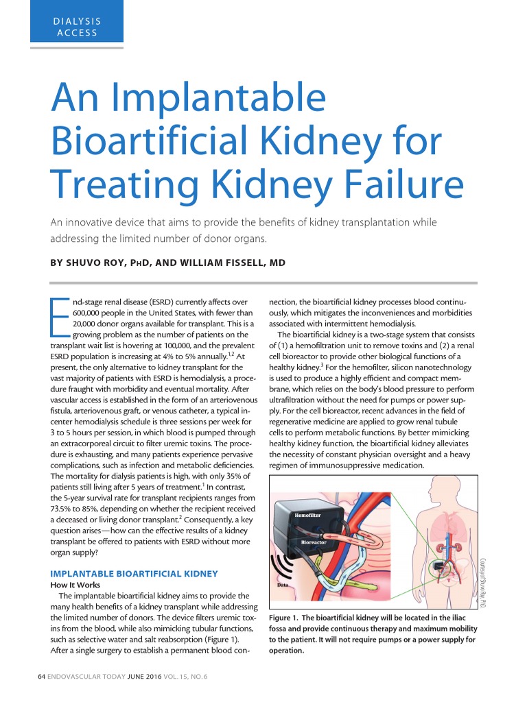 An Implantable Bioartificial Kidney For Treating Kidney Failure | PDF | Hemodialysis | Chronic ...