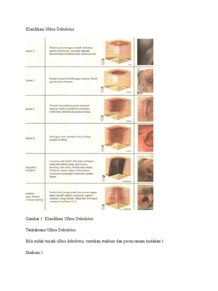 Ulkus Dekubitus | PDF