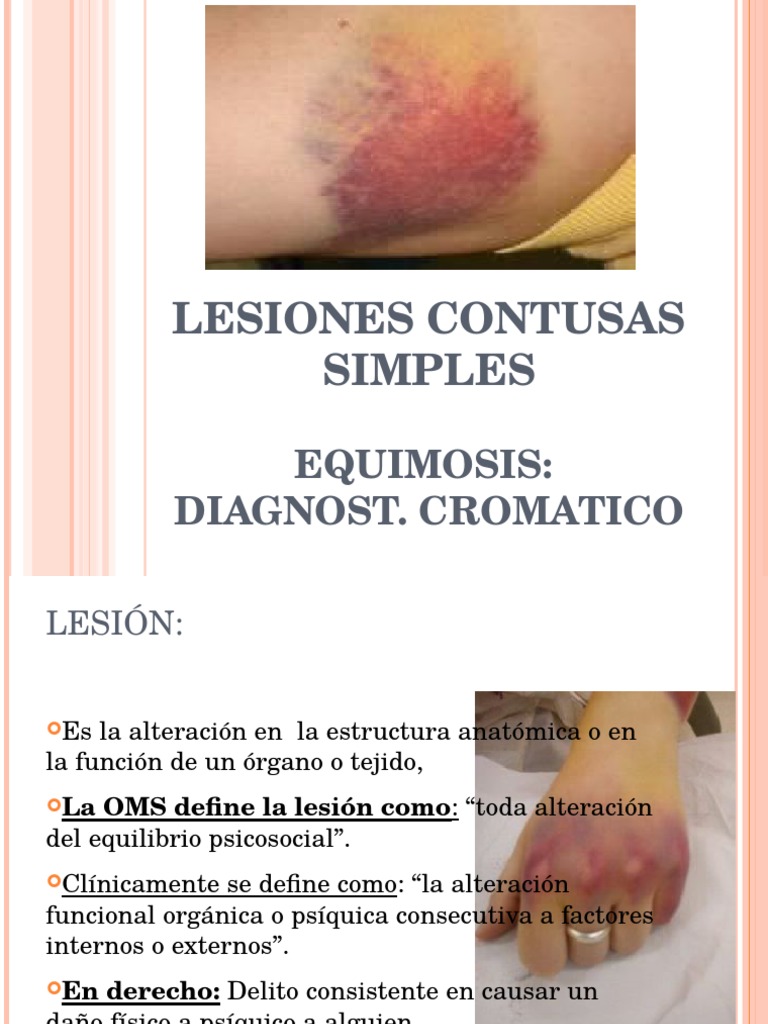 Lesiones Contusas Simples: Equimosis: Diagnost. Cromatico | Sangre | Piel