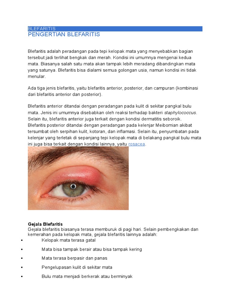 BLEFARITIS | PDF