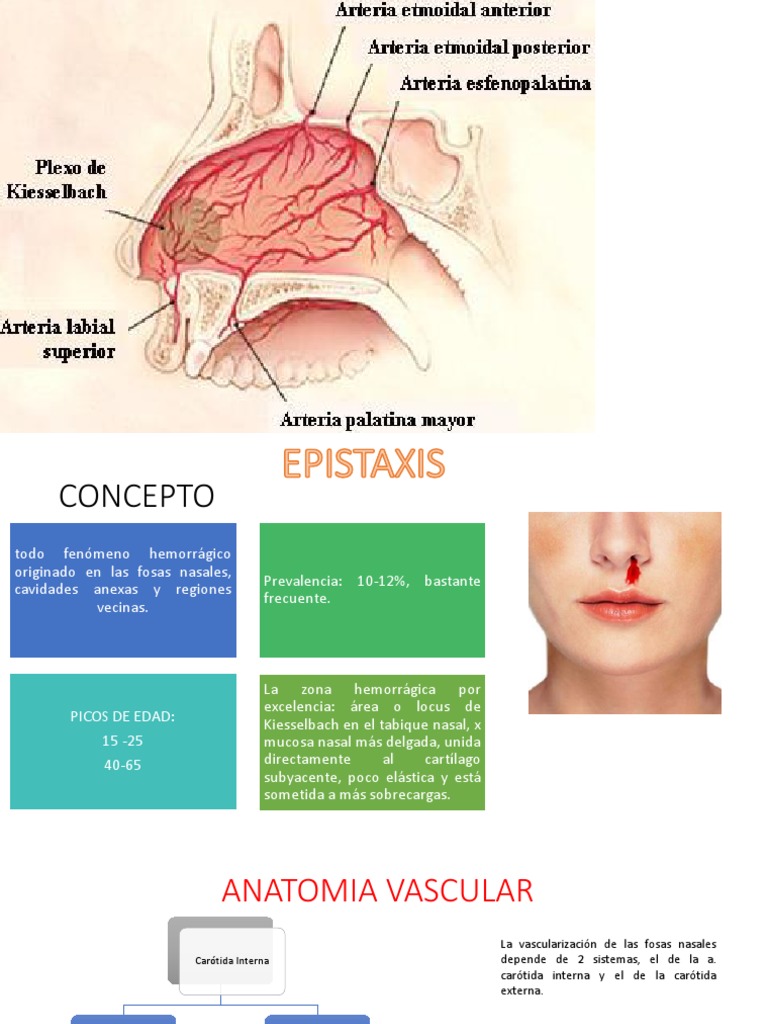 Epistaxis | PDF | Especialidades Medicas | Enfermedades y trastornos