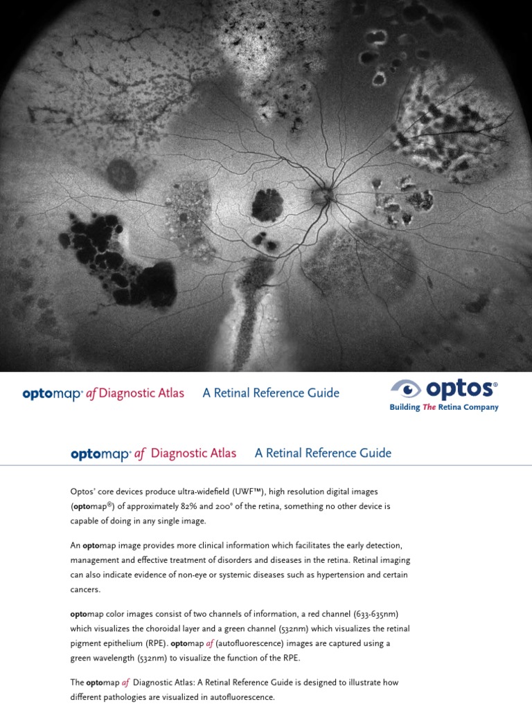 Optomap Af Diagnostic Atlas | PDF | Retina | Ophthalmology