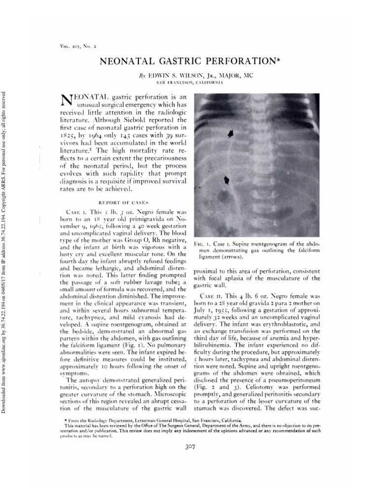 Neonatal Gastric Perforation : Fi) Win S. Wilson | PDF | Peptic Ulcer | Rtt