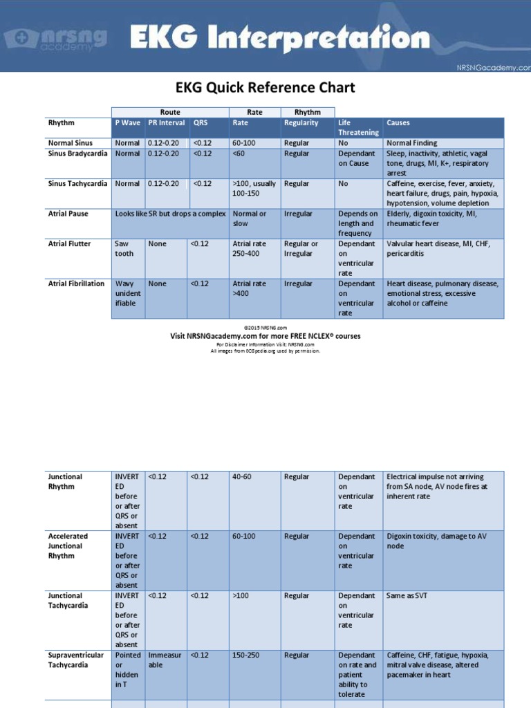 EKG Quick Reference Chart | PDF | Cardiac Arrhythmia | Diseases And ...