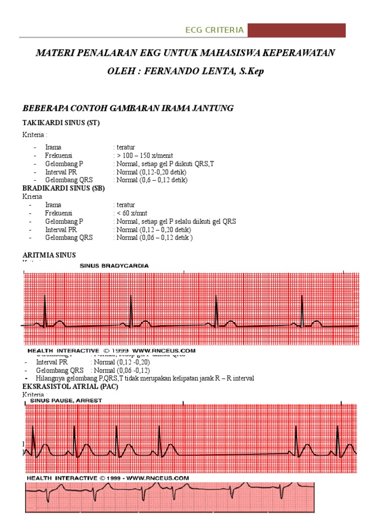 ECG Criteria | PDF