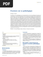 Classification des Fractures de Schatzker | PDF