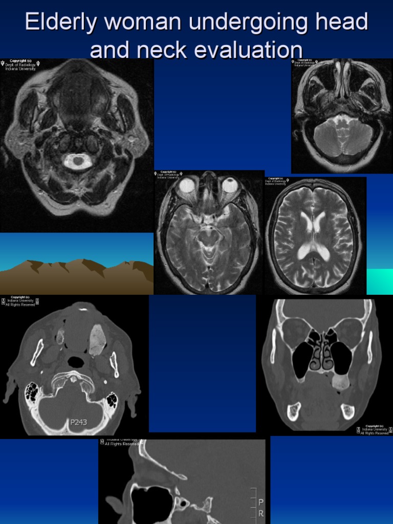 PRACTICAL EXAM PPT Radiology | PDF | Medical Specialties | Clinical ...