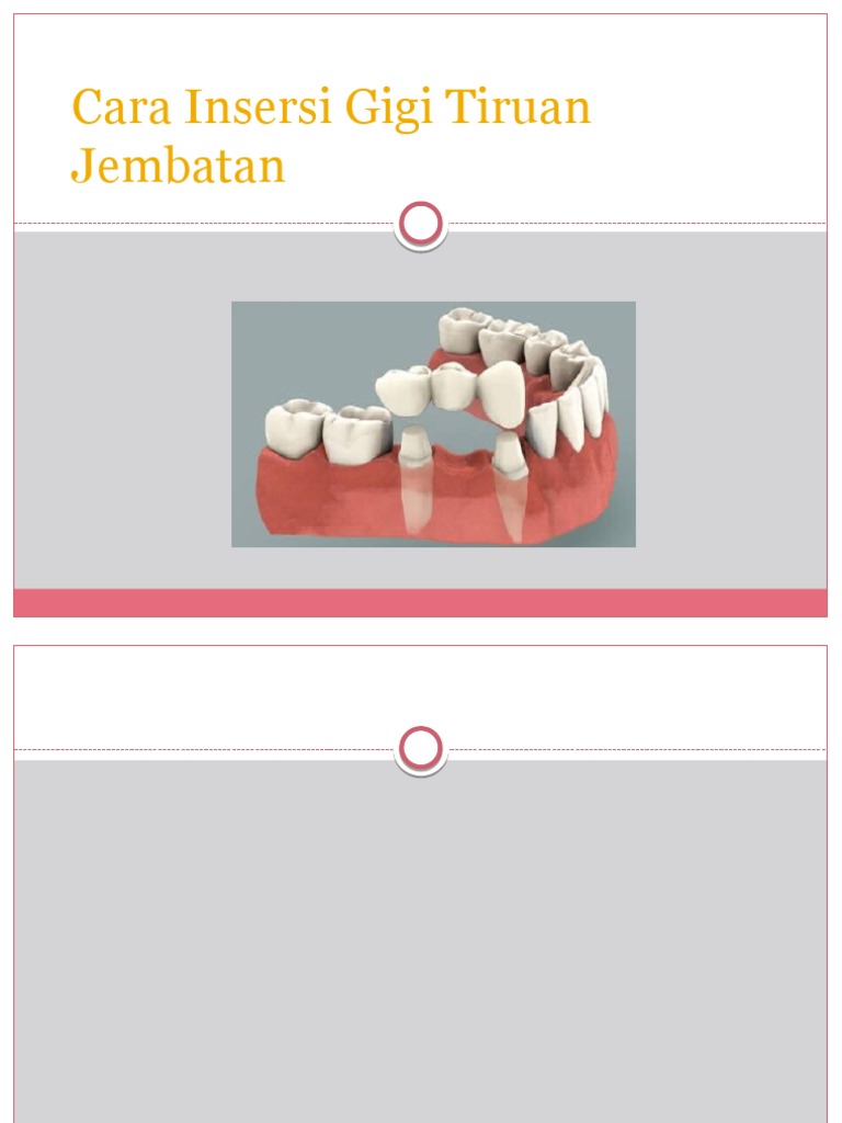Prosedur Insersi Gigi Tiruan Jembatan | PDF