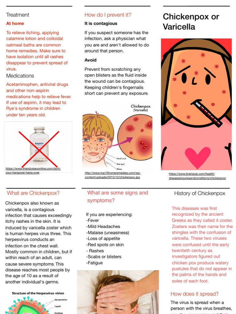 chickenpox | Rtt | Cutaneous Conditions