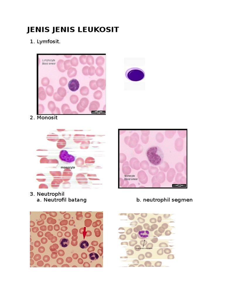 Jenis Jenis Leukosit | PDF