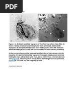 Double-Contrast Upper GI Exam Techniques | PDF | Esophagus | Stomach