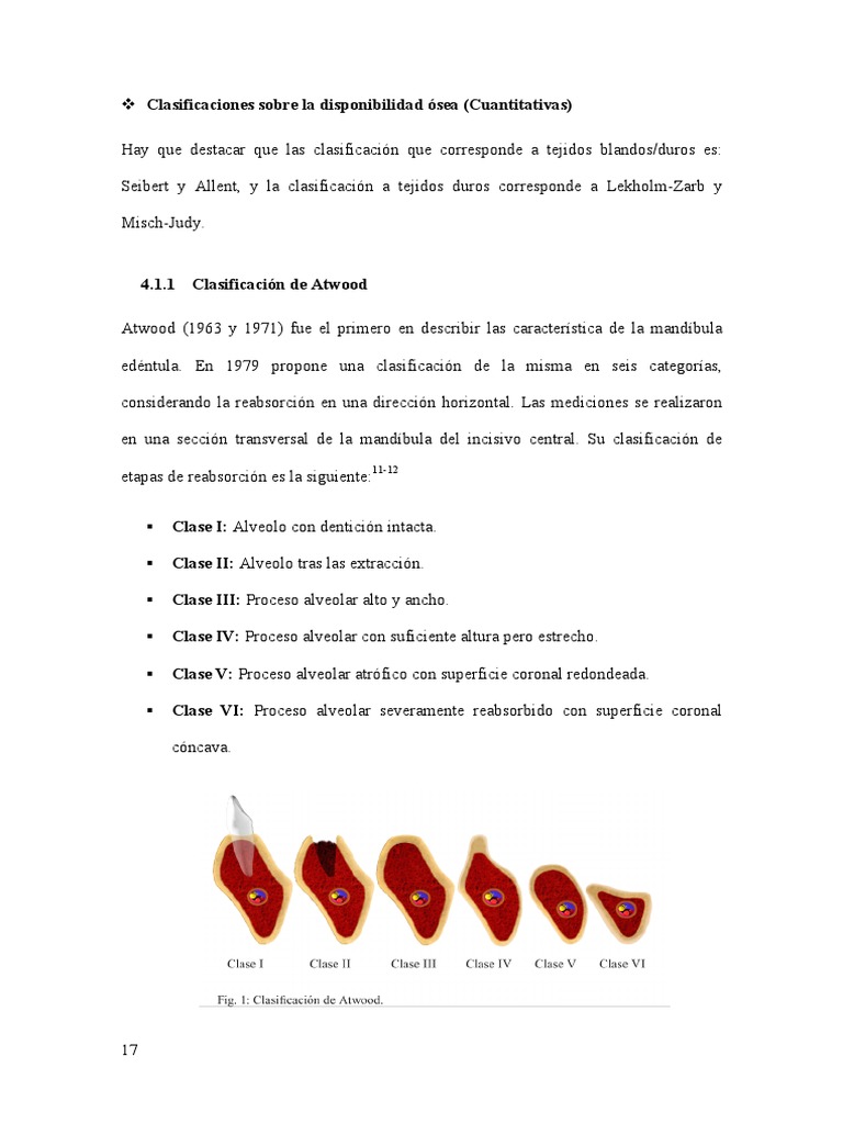 Clasificaciones de la disponibilidad ósea mandibular: descripción de la ...