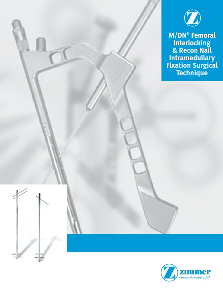 MDN Femoral Interlocking Recon Nail Intramedullary Fixation Metal Guide ...