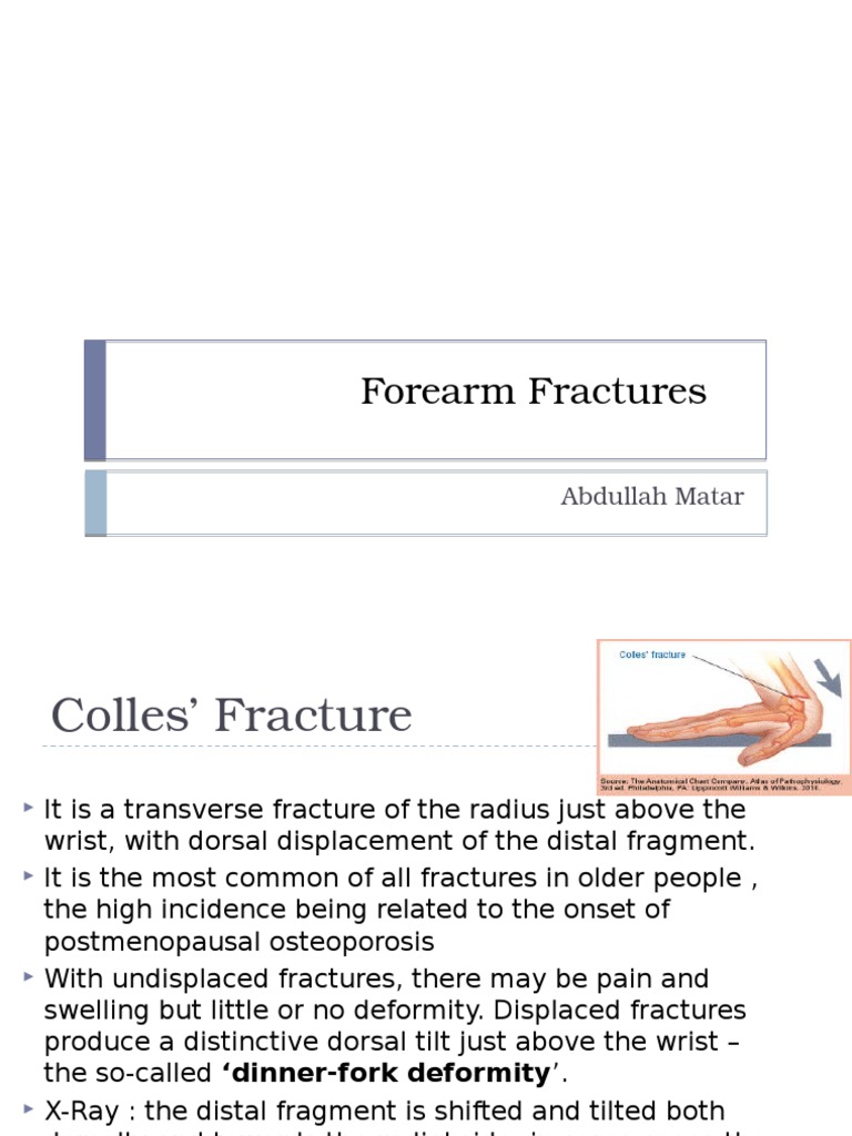Forearm Fracture Types and Treatments | PDF | Injury | Limbs (Anatomy)
