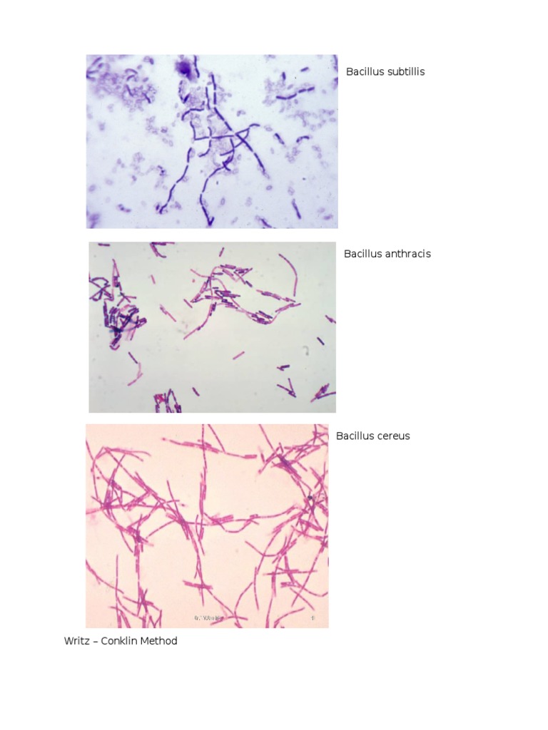 Bacillus Species Overview and Methods | PDF