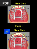 PDF Cartilha Grampos PPR | PDF | Dente | Prótese