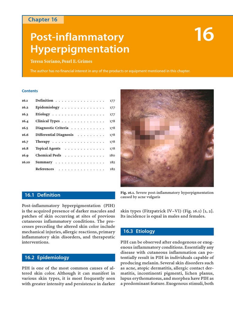 PIH by Teresa | PDF | Acne Vulgaris | Epidermis