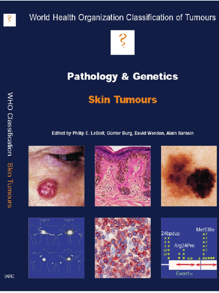 WHO - Pathology and Genetics of Skin Tumours | Skin Cancer | Carcinoma