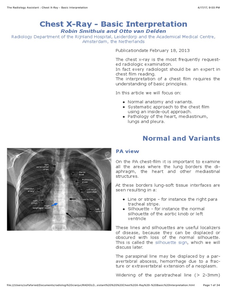 The Radiology Assistant: Chest X-Ray - Basic Interpretation | PDF ...