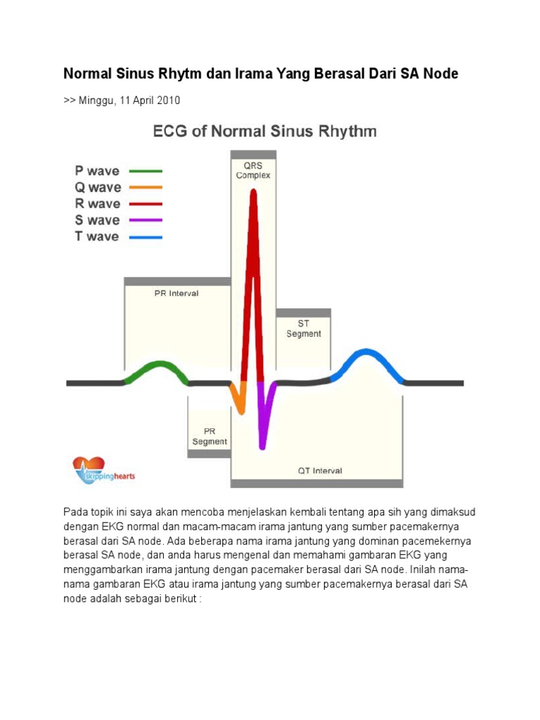 Normal Sinus Rhytm Dan Irama Yang Berasal Dari SA Node | PDF