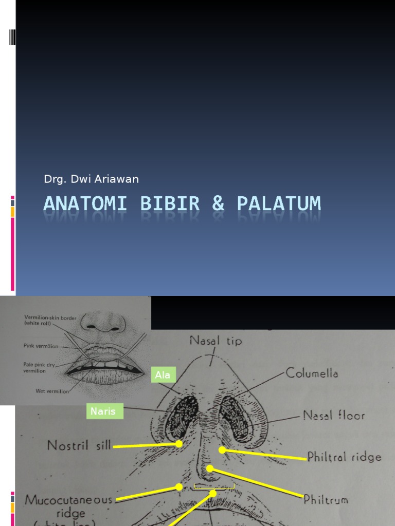 Anatomi Cleft Lip & Palate | PDF