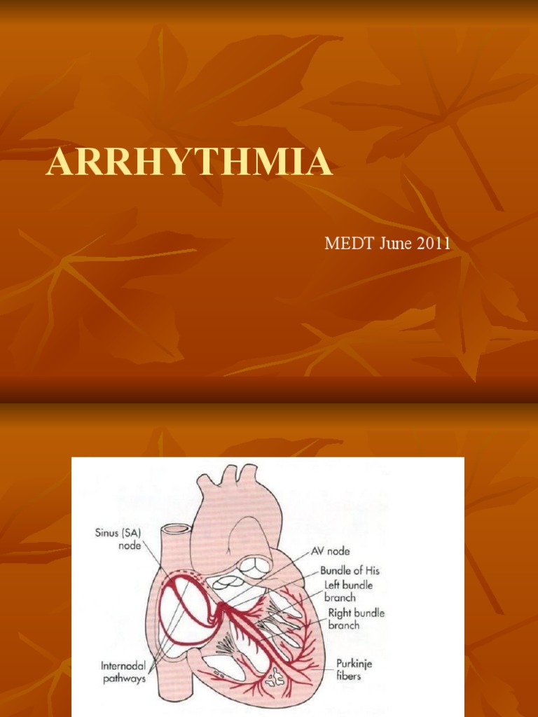 ECG (Rythm Interpretation) | PDF | Internal Medicine | Cardiac Arrhythmia