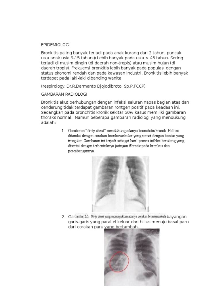 Radiologi Bronkitis | PDF