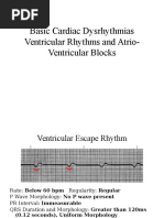 Pac PJC PVC | PDF | Cardiac Electrophysiology | Cardiac Arrhythmia