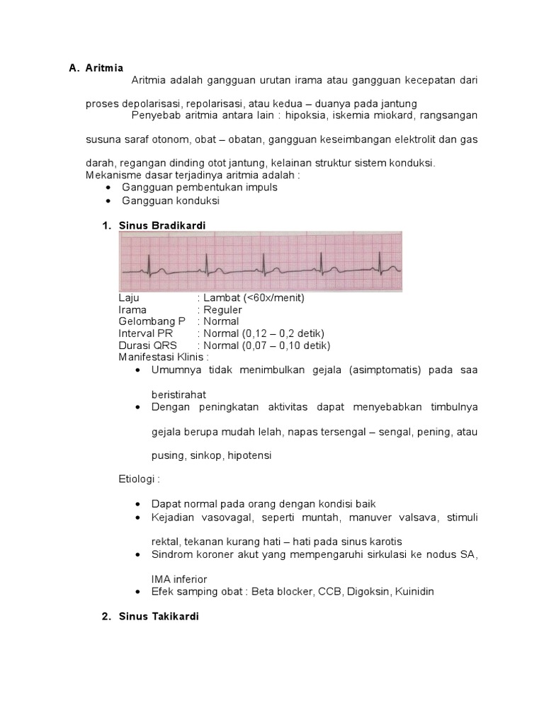 Gangguan Irama EKG | PDF