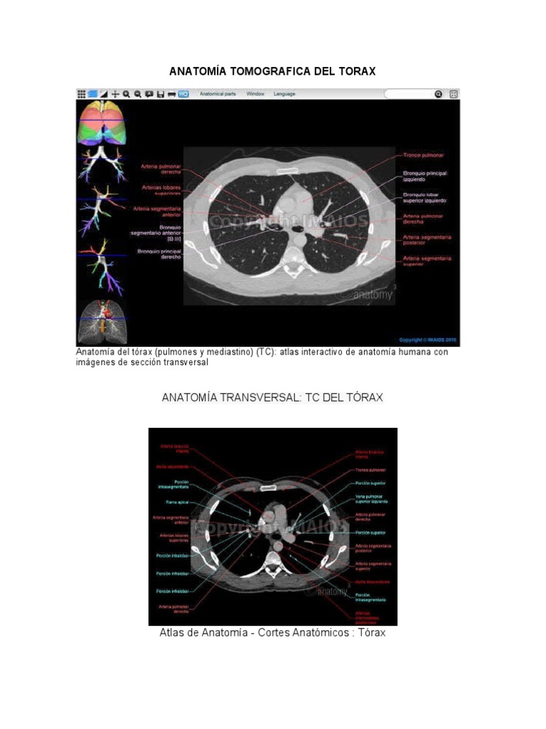 Anatomía Tomografica Del Torax | PDF