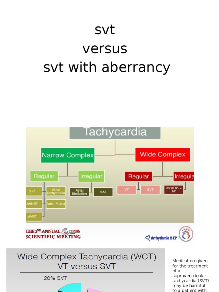 VT Vs SVT Aberrant | PDF | Cardiovascular Diseases | Internal Medicine