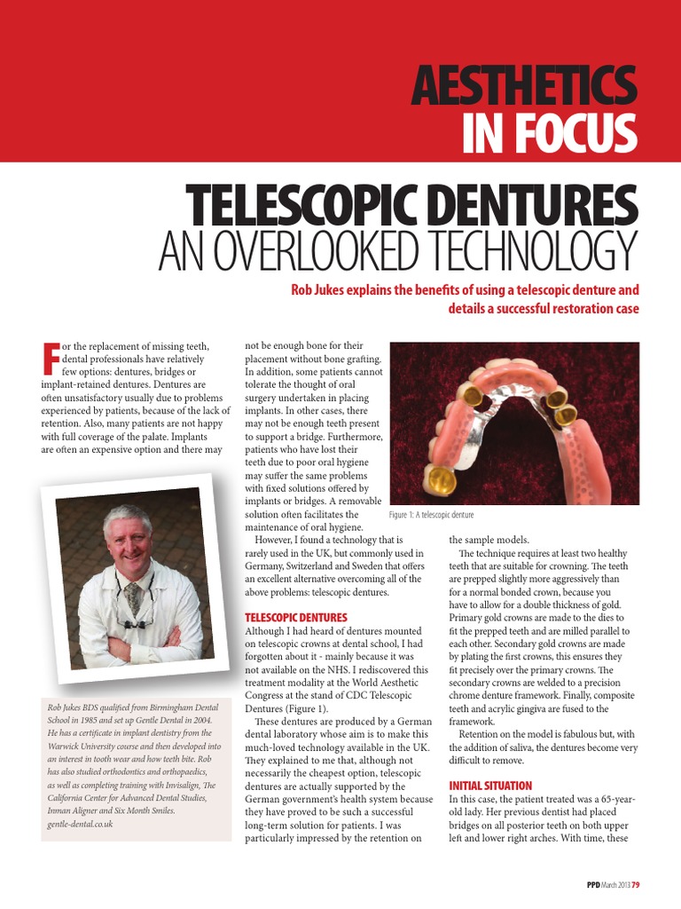 Telescopic Dentures: An Overlooked Technology | PDF | Dentures | Dental ...