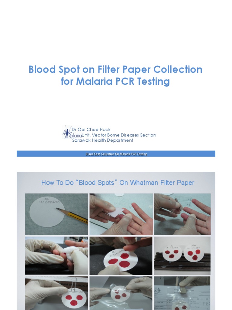 Blood Spot For PCR S | PDF