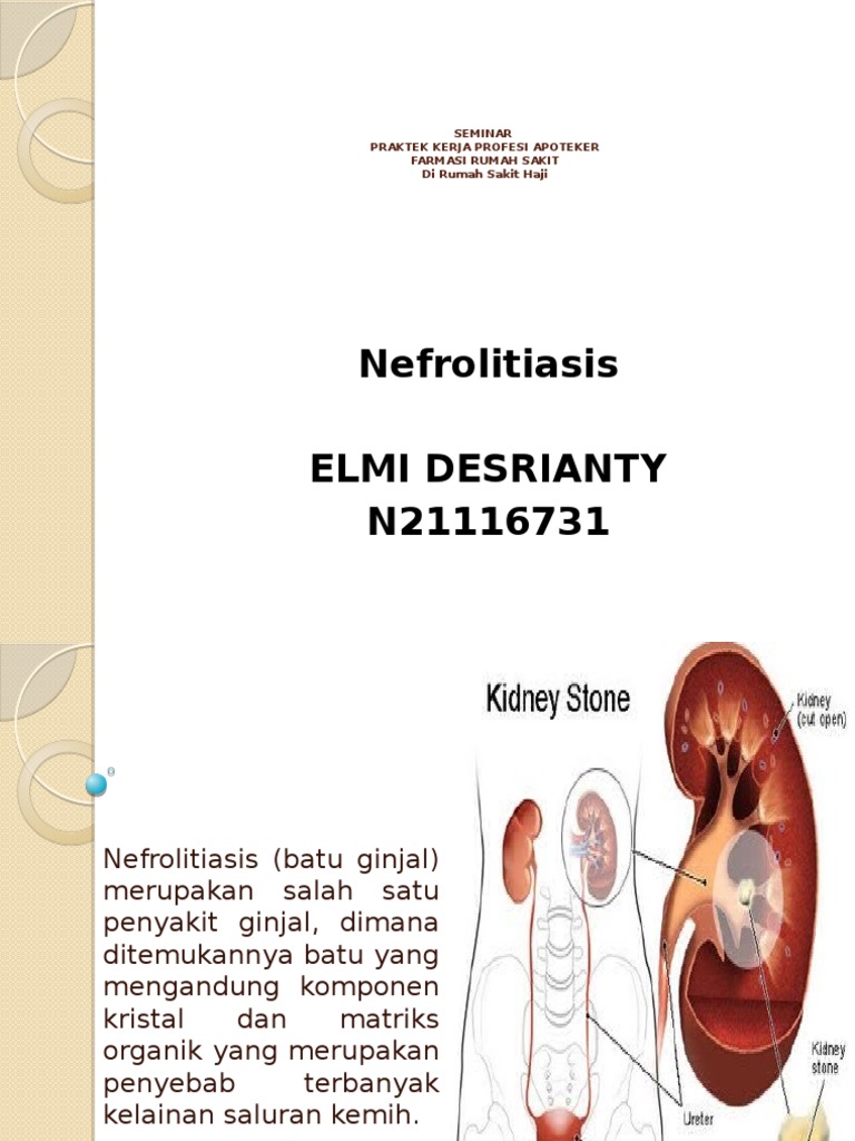 Nefrolitiasis | PDF