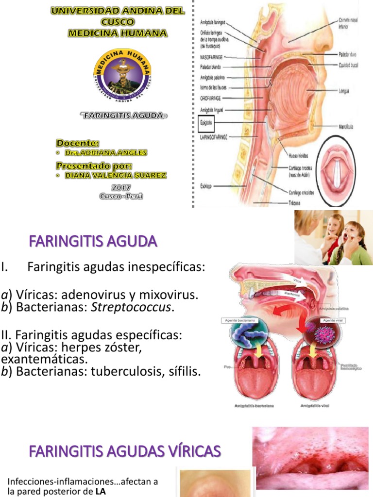 Faringitis Aguda. | PDF | Inmunología | Medicina CLINICA