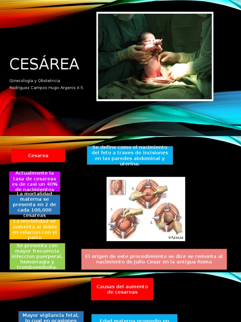 Cesárea: Indicaciones y Riesgos | PDF