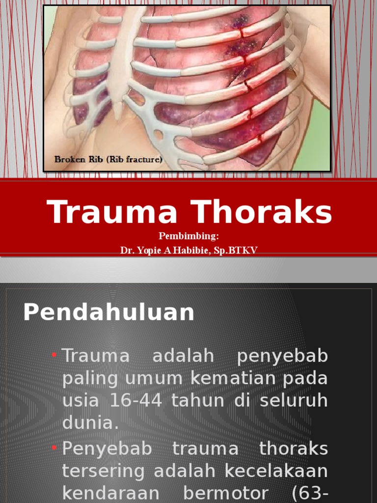 Trauma Thoraks FIX | PDF