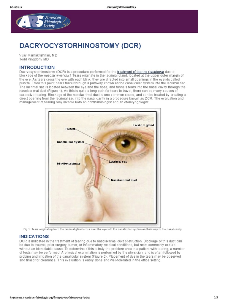 Dacryocystorhinostomy | PDF | Surgery | Human Head And Neck