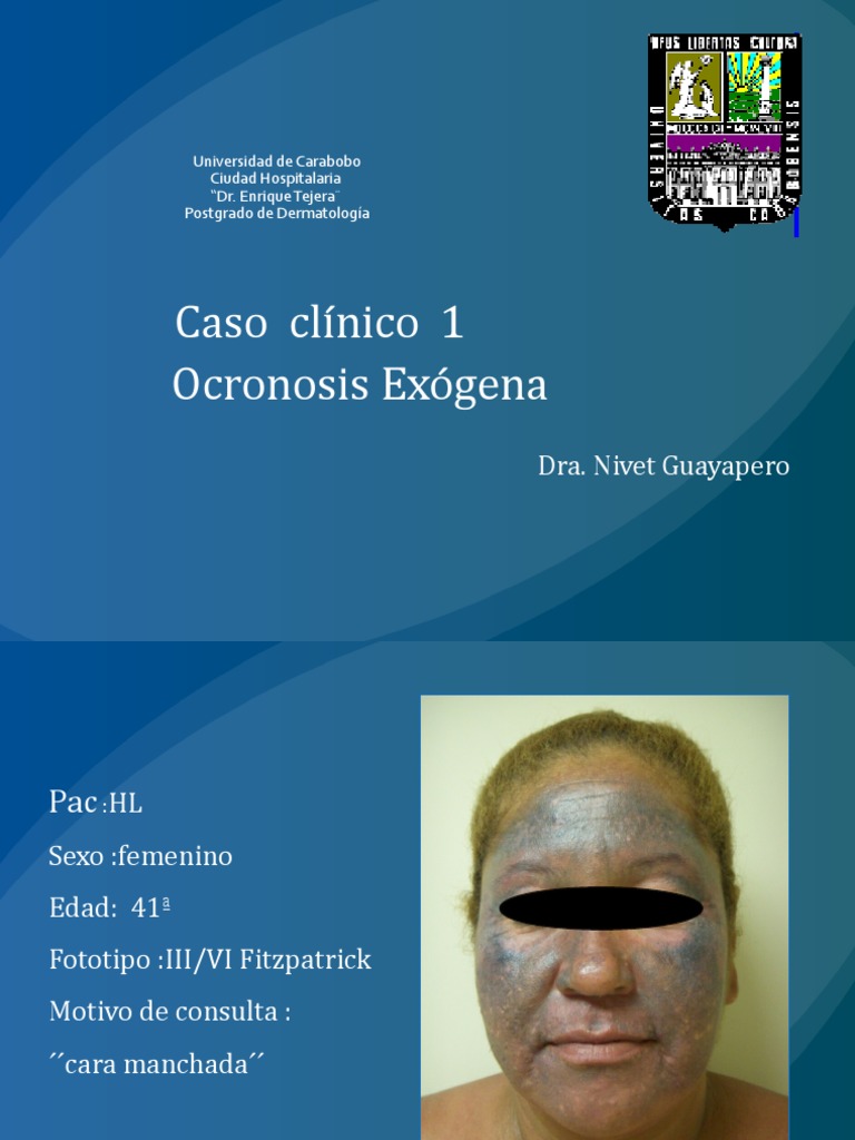 Ocronosis Exógena | PDF | Medicina | Enfermedades y trastornos