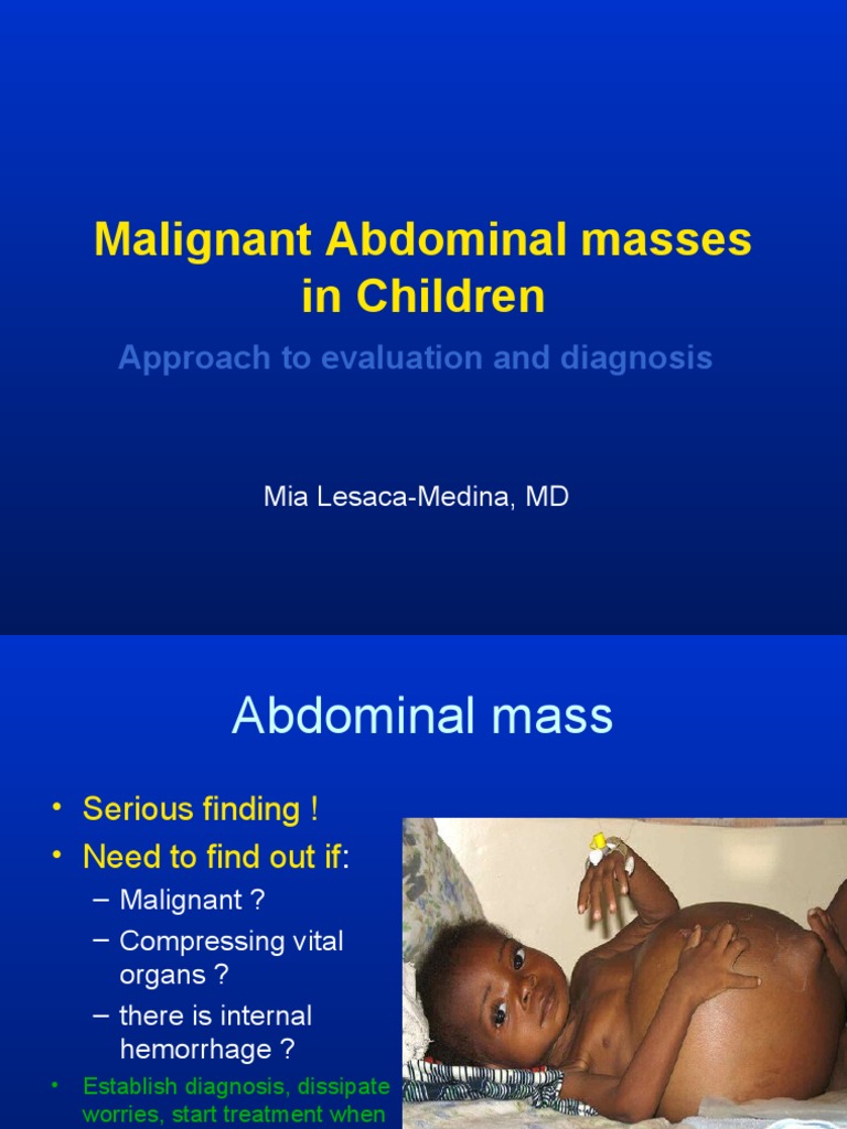 Pediatric Abdominal Masses Overview | PDF | Cancer | Teaching Mathematics