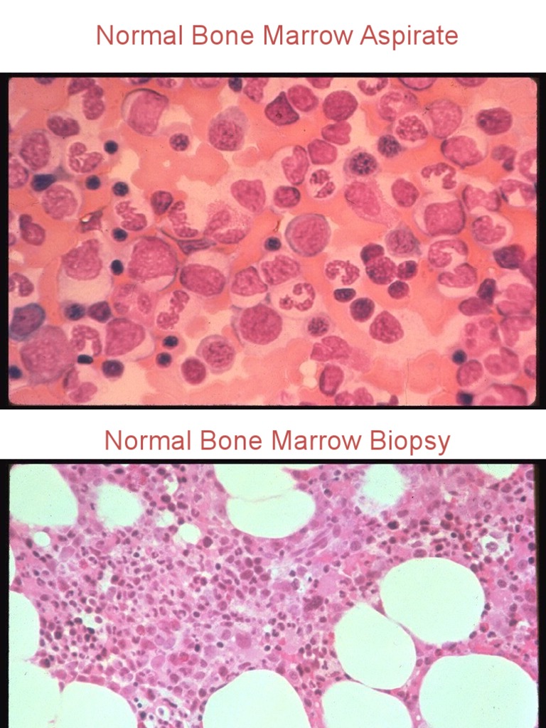 Gambar Sel Darah Normal | PDF | White Blood Cell | Platelet