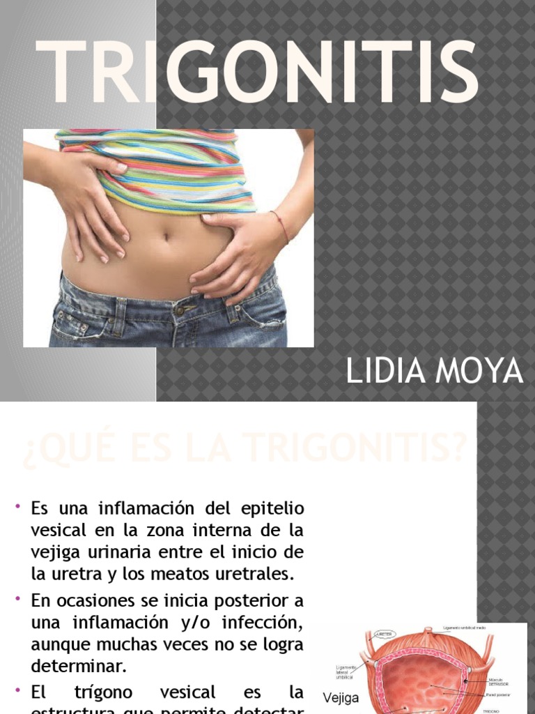 Trigonitis: Causas, Síntomas y Tratamiento | PDF | Vejiga urinaria ...